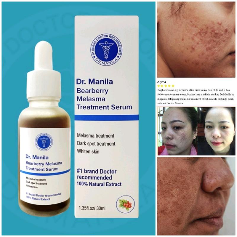Dr. Manila Melasma Treatment Serum Bearberry serum - TikTok Shop Philippines