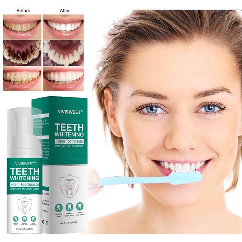 Teeth Cleaning Mousse Removes PlaqueMouth Odor Brightens Teeth ...